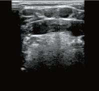 China Radio de diagnóstico del equipo del escáner del ultrasonido del PDA con 8 ajustes de TGC en venta