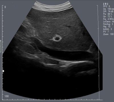 China 3d Color Doppler Ultrasound Scanner / Hand Held Doppler With Built - In Battery for sale