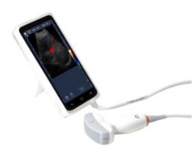 China Doppler-Ultraschall-Maschine der hohen Auflösung tragbare mit 6 Zoll-vollem Touch Screen for sale