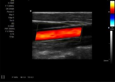 Cina Analizzatore portatile di ultrasuono della macchina di rappresentazione di ultrasuono con capacità 160G in vendita