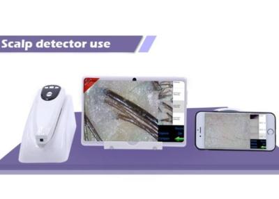 China Digital Microscope for Skin and Scalp Video Dermatoscope with 2 Million Pixels for sale