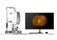 China 2mm 16fps Laser Scanning Digital Fundus Camera for sale