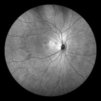 China 2mm 16fps Laser Scanning Digital Fundus Camera for sale