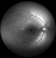 China 2mm 16fps Laser Scanning Digital Fundus Camera for sale