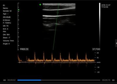 China Pocket Wireless Ultrasound Probe Handheld Ultrasound Probe Mini Ultrasound Only 235g Weight 128 Elements 2.4G Wifi for sale