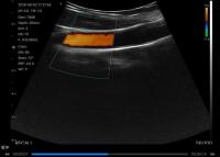 China Digital Wireless Handheld Ultrasound Scanner for sale