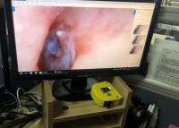 China 4 Led Cold Light Continuous Working Time 10h Digital Ear Scope for sale