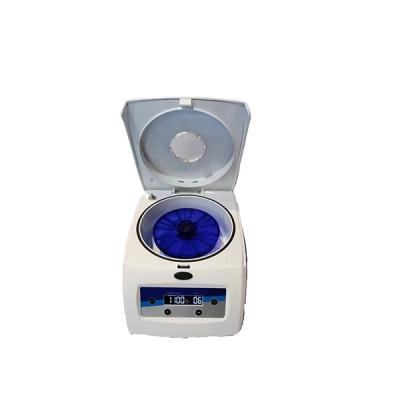 China SmartSpin CENTRIFUGE 40mm Hematocrit Micro Centrifuge: Adjustable Speed, Easy to Operate for sale