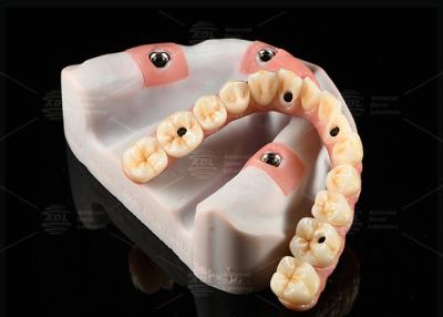 China Hybrid Pink Porcelain Implant Crown Malong Full Arch Implant Bridge Immediate Loading for sale