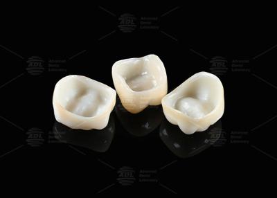 China Natural Full Contour Zirconia Crown Precise Fit Full Contour Dental Lab for sale