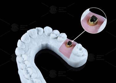 China Customized Titanium Base Corrosion Resistance Dental Implants And Solutions for sale