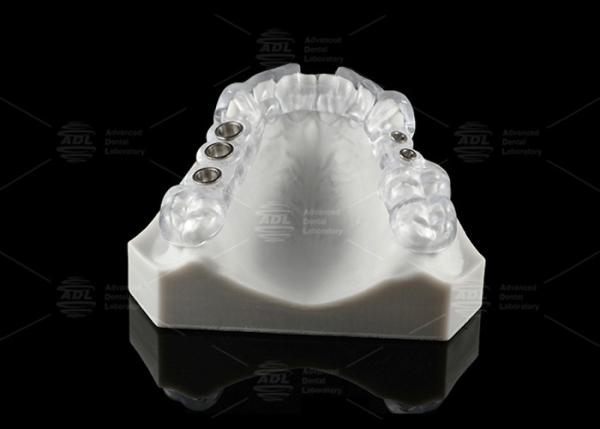 Quality Custom Made Transparent Dental Implant Solution Surgical Stent Ergonomic Design for sale