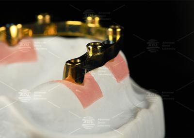 China Titanium Sandblasted Implant Locator Bar Silver Gold Dental Implant Locator Attachment for sale