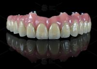 Quality China Dental Lab Hybrid Bridge Implant Bar Malong Design Screw retained Or for sale