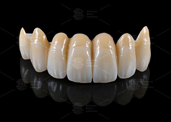 Quality China Dental Lab Providing AIDITE ZIRCONIA BLOCK Materials Alongside Turnaround Time In 72 Hours For Dental Manufacturing for sale