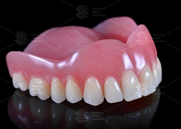 Quality China Dental Lab High Esthetics Customized Full Acrylic Denture Full Service for Worldwide for sale