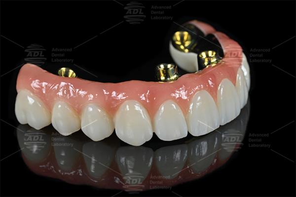 Quality Professional Dental Lab Outsourcing Services Delivering Accurate Dental Prosthetics and Custom Solutions for Dental Industry Needs for sale