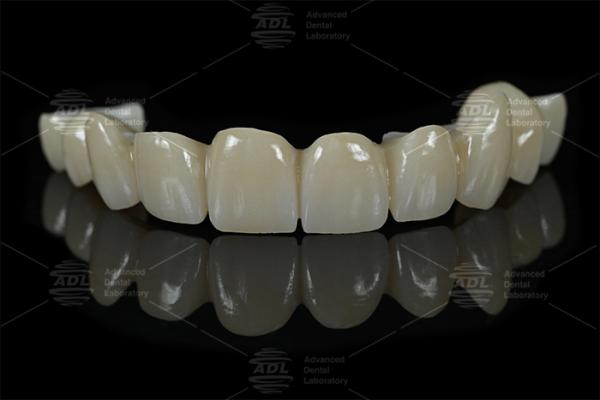 Quality China Dental Lab Full Zirconia dental restorations dental lab specializing in AIDITE ZIRCONIA BLOCK materials for durable dental solutions for sale