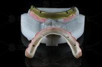 Quality China Dental Lab Compatible With Most Dental Implant Systems All on 4 Offering for sale