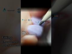 natural pressed emax veneer strength 16 shades emax teeth veneers