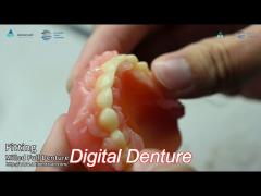Discover the Power of Milled Full Denture Aesthetically Pleasing and Natural-Looking for Perfect Smiles