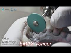 透明性 CAD EMAX フェニエール ポーリング ガラスのセラミック リスタベーション 前後部用