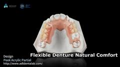 Partial Denture Comfort & Strength