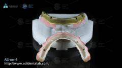 Premium Dental Restorations Fast Turnaround