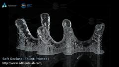 Custom 3D Printed Night Guard for Teeth Grinding Relief