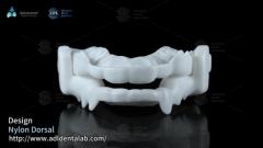Stop Teeth Grinding With Custom Nylon Dorsal Night Guards