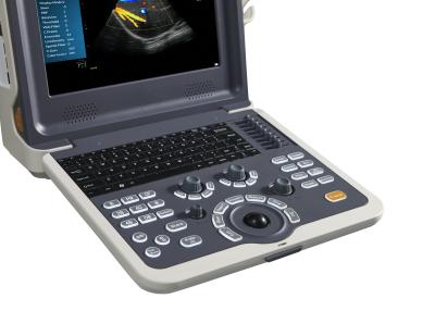 China Van de de Scanner Slimme Kleur van de USB-poort het Draagbare Ultrasone klank Systeem van Doppler Te koop