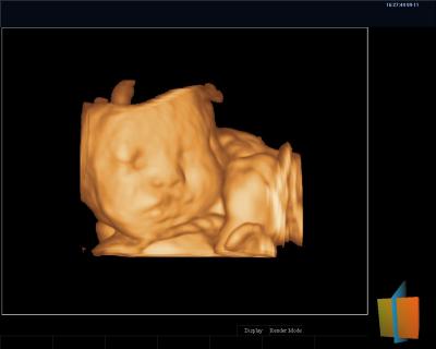 Cina macchina di ultrasuono di Doopler di colore 60Hz con il touch screen a 8,4 pollici in vendita