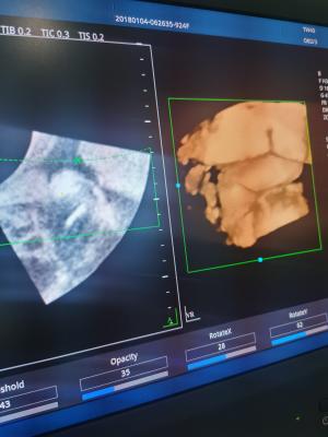 Cina macchina di ultrasuono di Doopler di colore 60Hz con il touch screen a 8,4 pollici in vendita
