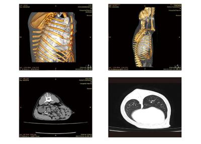 Cina 32 macchina dell'analizzatore di ricerca X Ray Veterinary Clinic CT di CT per l'animale in vendita