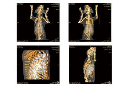 Cina 32 macchina dell'analizzatore di ricerca X Ray Veterinary Clinic CT di CT per l'animale in vendita