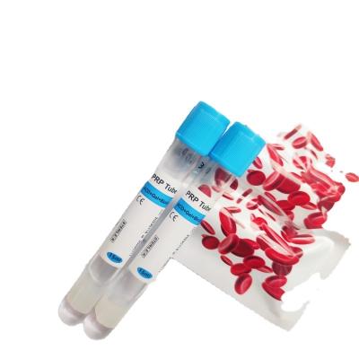 China Rich Plasma Separation Tube With ACD Gel Boitin for Hair /OZM Vacuum Blood Collection Tube for sale