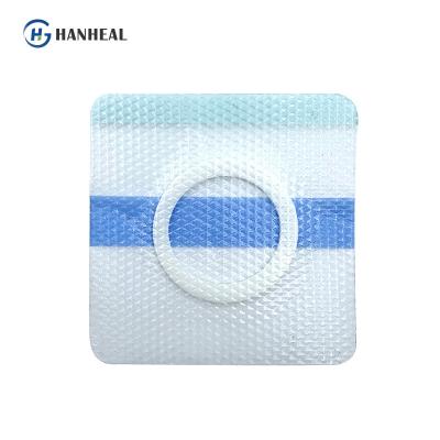 China Skin Friendly Breathable Clear Wound Care Dressing For Baby'S Navel Neonatal Hip Hernia for sale
