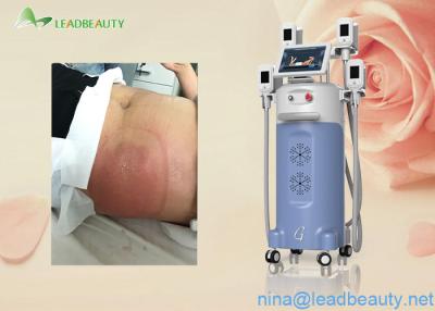 China Great weight loss 0kpa-100kpa Vacuum machine cryolipolysis for sale