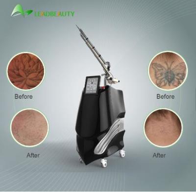 China Tattoo removal birthmark removal 1064/532nm laser  Picosecond laser machine for sale