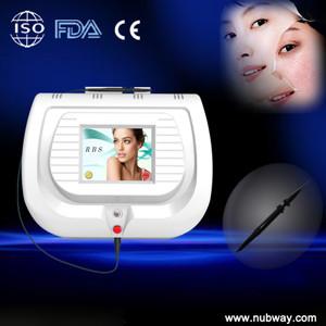 China amazing result portable spider vein removal machine on face for beauty salon for sale