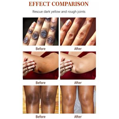 China Face Black Freckle Acne Fade Dark Spot Removing Corrector Whitening Cream for sale