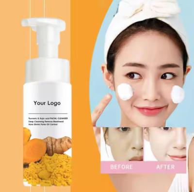 China Turmeric Kojic Acid Mousse Clean Clear Skin Niacinamide Brightening Foaming Face Wash Cleanser for Dark Spots Skin for sale