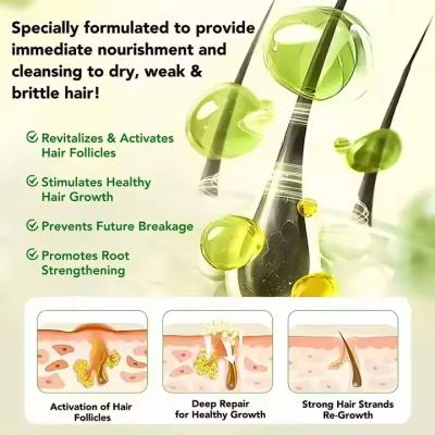 Cina OEM / ODM 100% olio di albero di tè biologico naturale infuso rosmarino siero per la cura del cuoio capelluto Il nostro proprio trattamento dei capelli di marca e olio di crescita per uomini donne in vendita