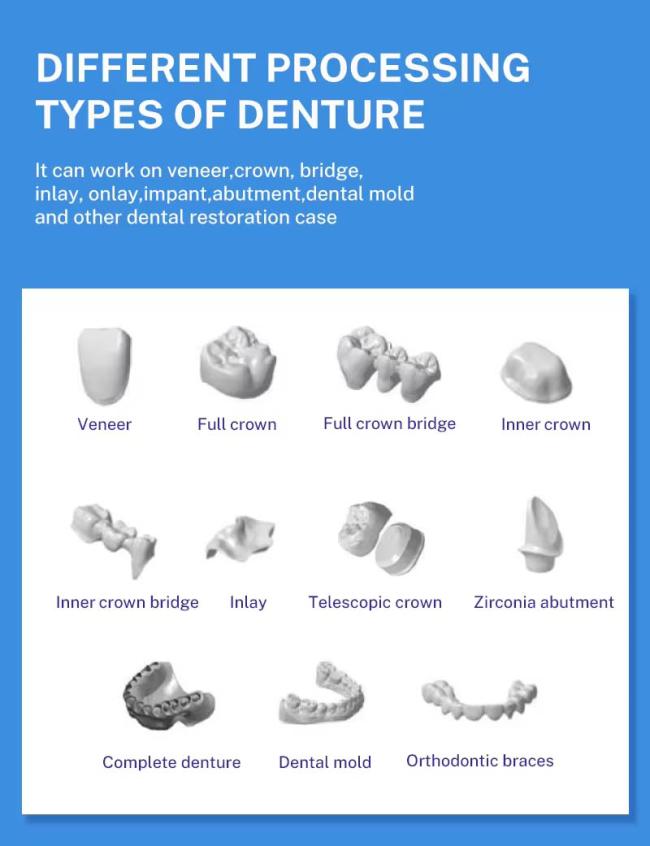 Dental restoration types