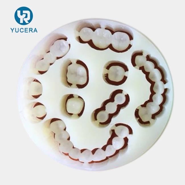 Yucera PMMA dental material in use