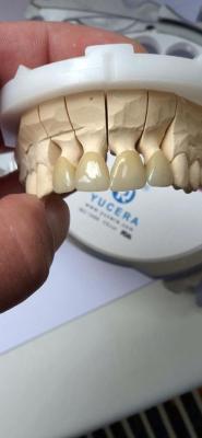 China Yucera ST color 3D Multilayer Zirconia Block - Precision - Engineered for CAD/CAM Dentistry for sale