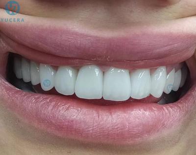 Китай Обработка филировальной машины зуба 5 осей вертикальная горизонтальная для PMMA продается