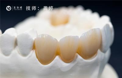 China Yucera 3D Plus Multilaer Zirconia Block 98x16mm Open System For Posterior Crown for sale