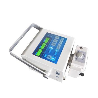 China Máquina de raios-X digital de eletricidade com processamento e aprimoramento automático de imagem à venda