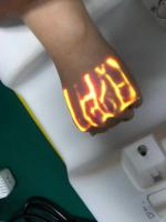 China Vein finder machine for sale